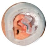 EarWell: Revolutionary Infant Ear Correction for Ideal Ears